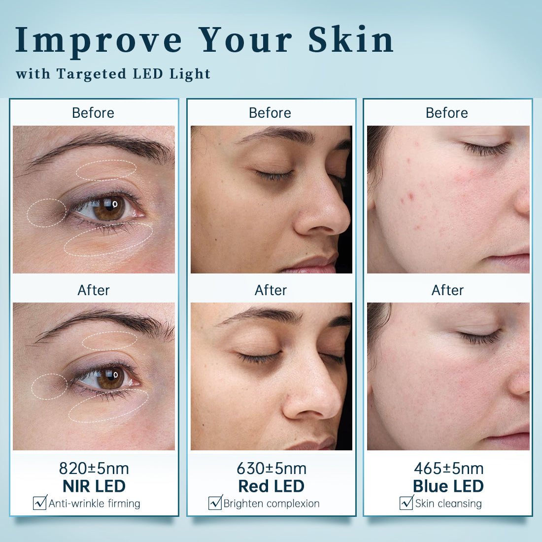 GYH Cloud-SSS 8-Color LED Face Mask Light Therapy,FDA Cleared, Acne Re ...